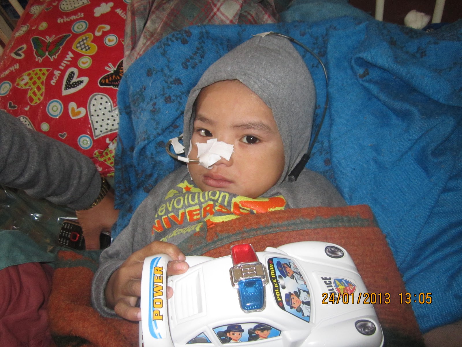 Stoma Care : Paediatric ostomy care at a glance